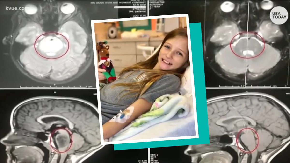 Roxli's onverwoestbare hersentumor verdween na gebed: "God - EO BEAM